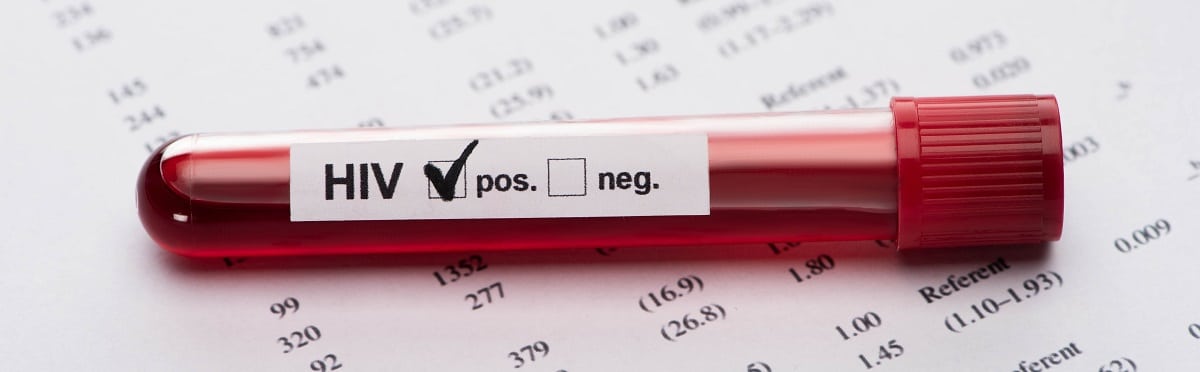 Onusida espera que el sida finalice antes de 2030 | @diariofarma